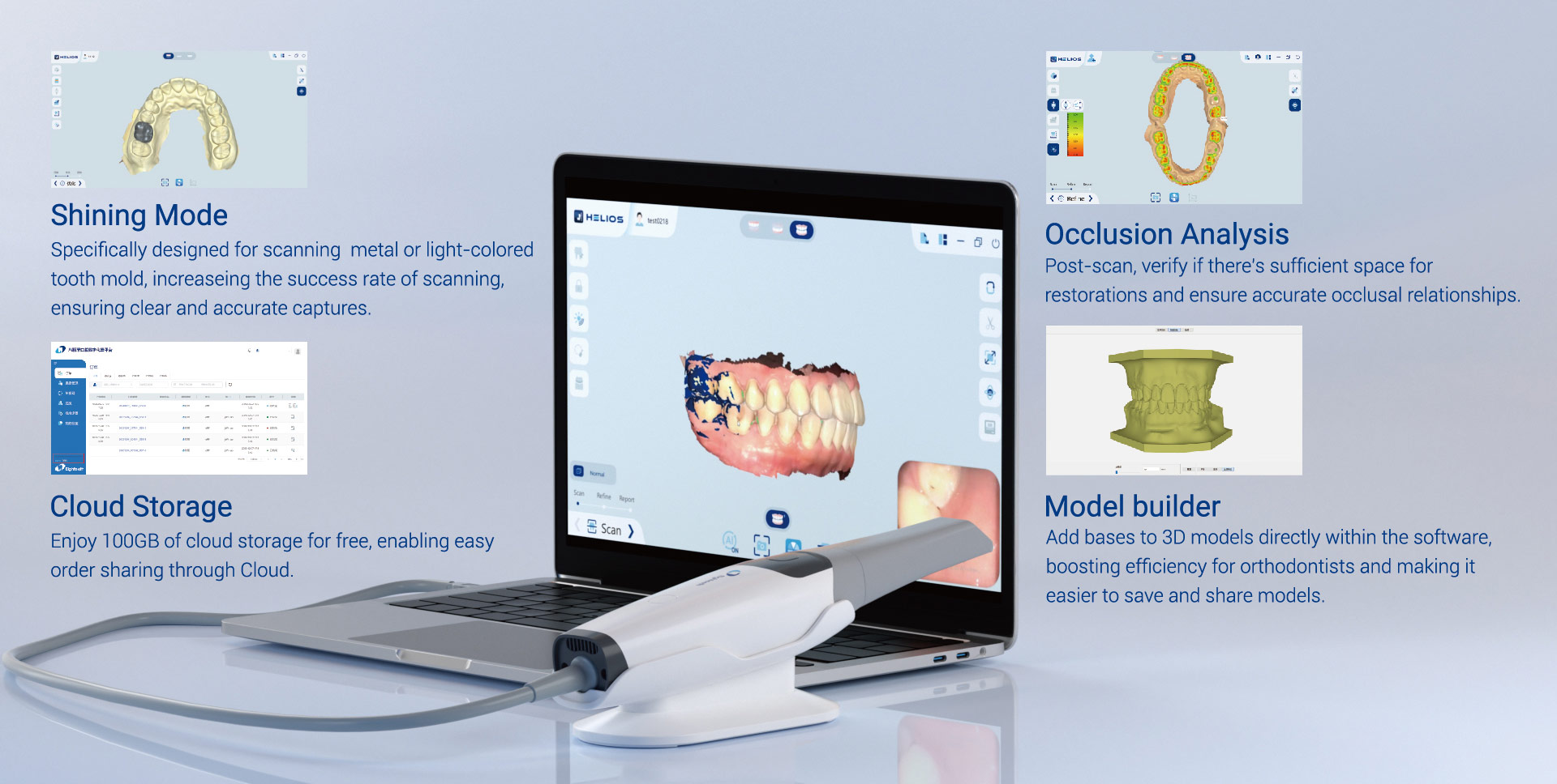 Helios 500 - Intraoral Scanner - Changzhou Sifary Medical Technology Co ...